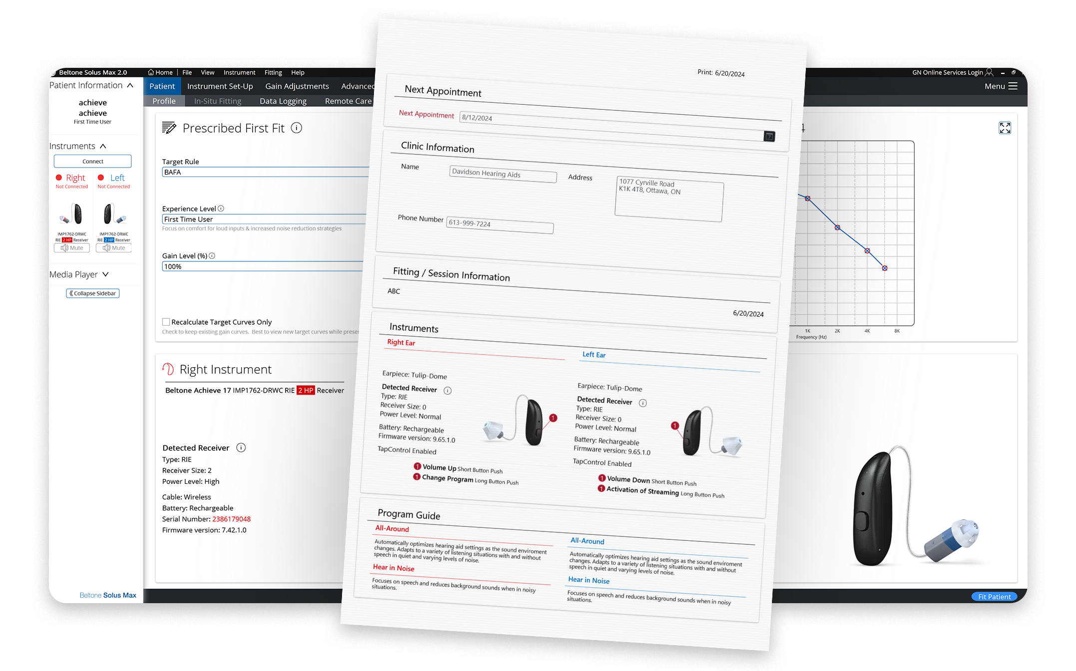 NEW! Beltone Solus Max 2.0 - Developed for your expertise and care ...